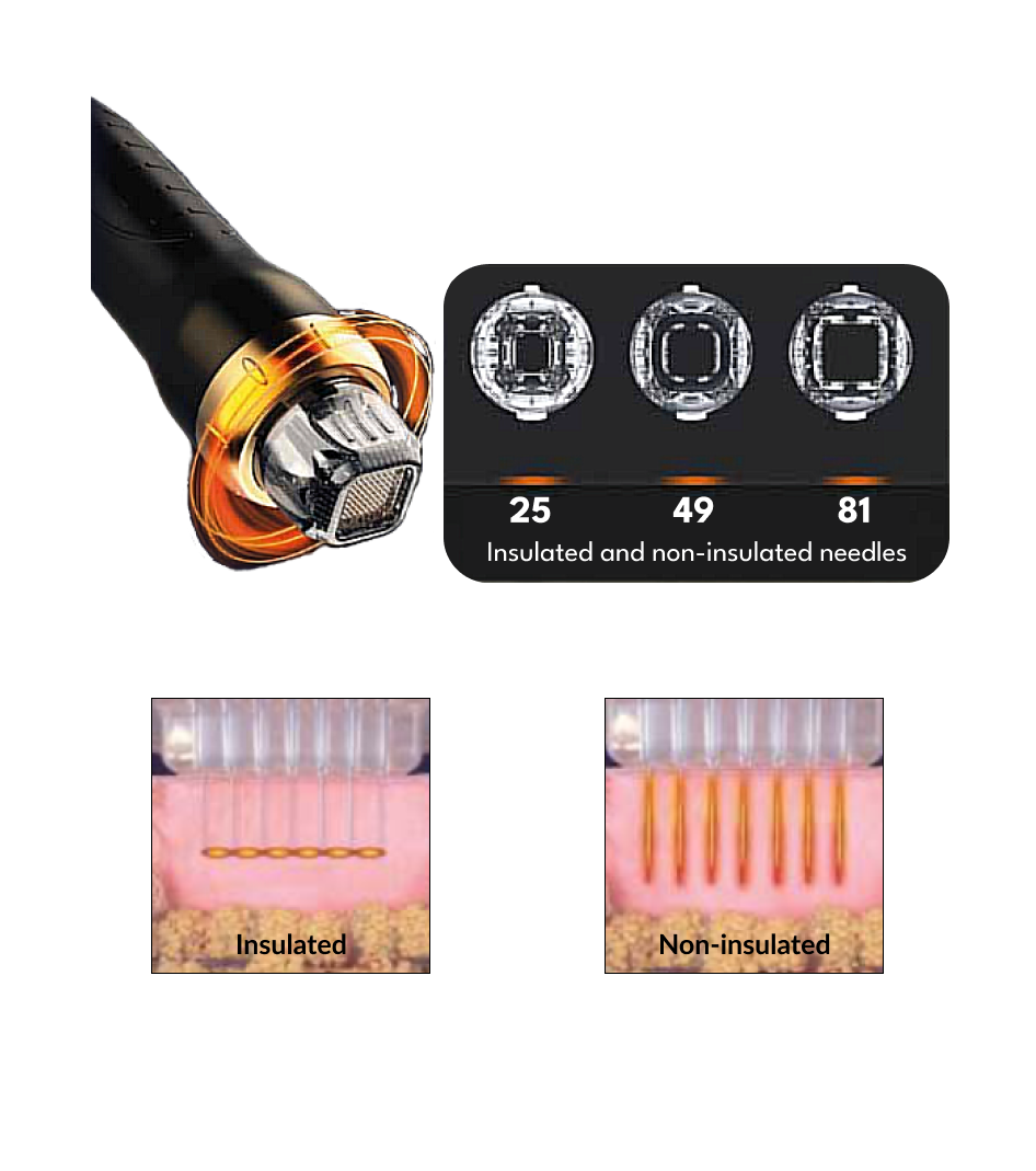 Chronos RF: Advanced Radiofrequency Microneedling